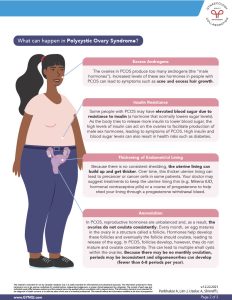 Polycystic Ovary Syndrome (PCOS) - Information & Treatment