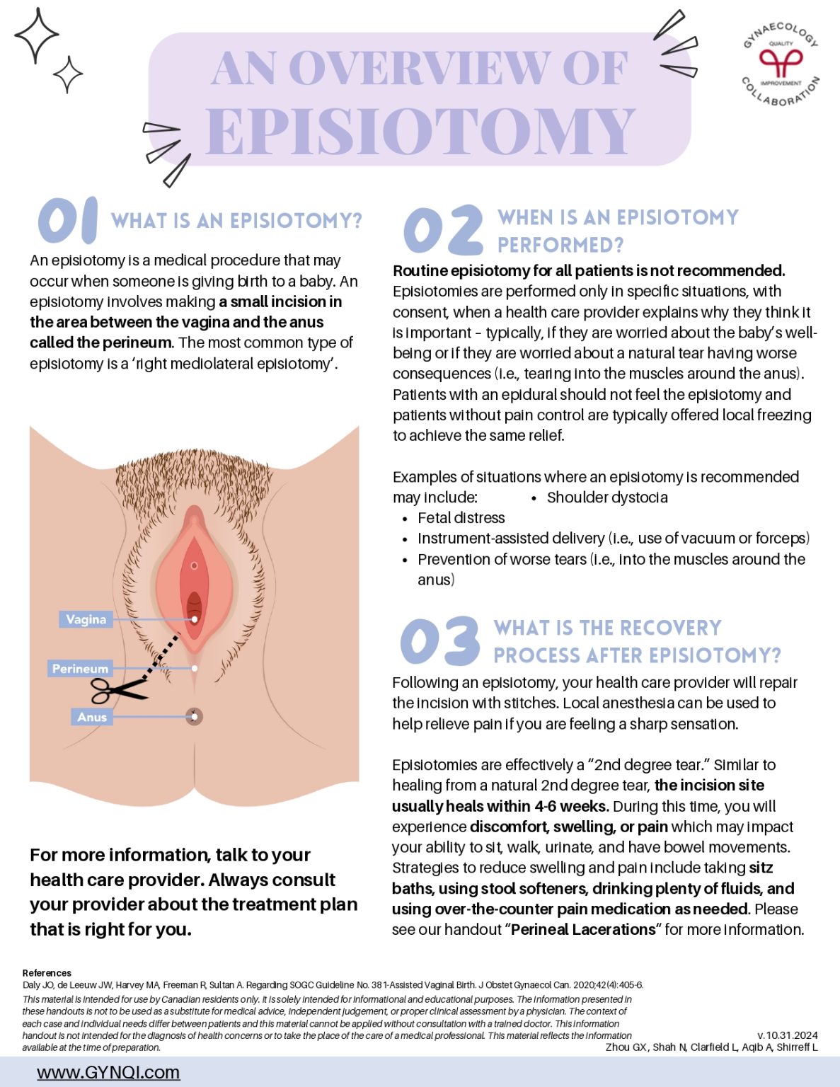 Episiotomy